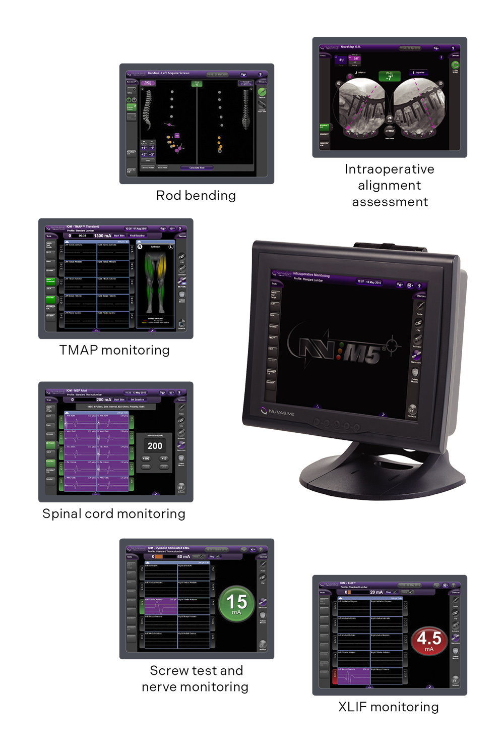 IONM Technologies | NCS